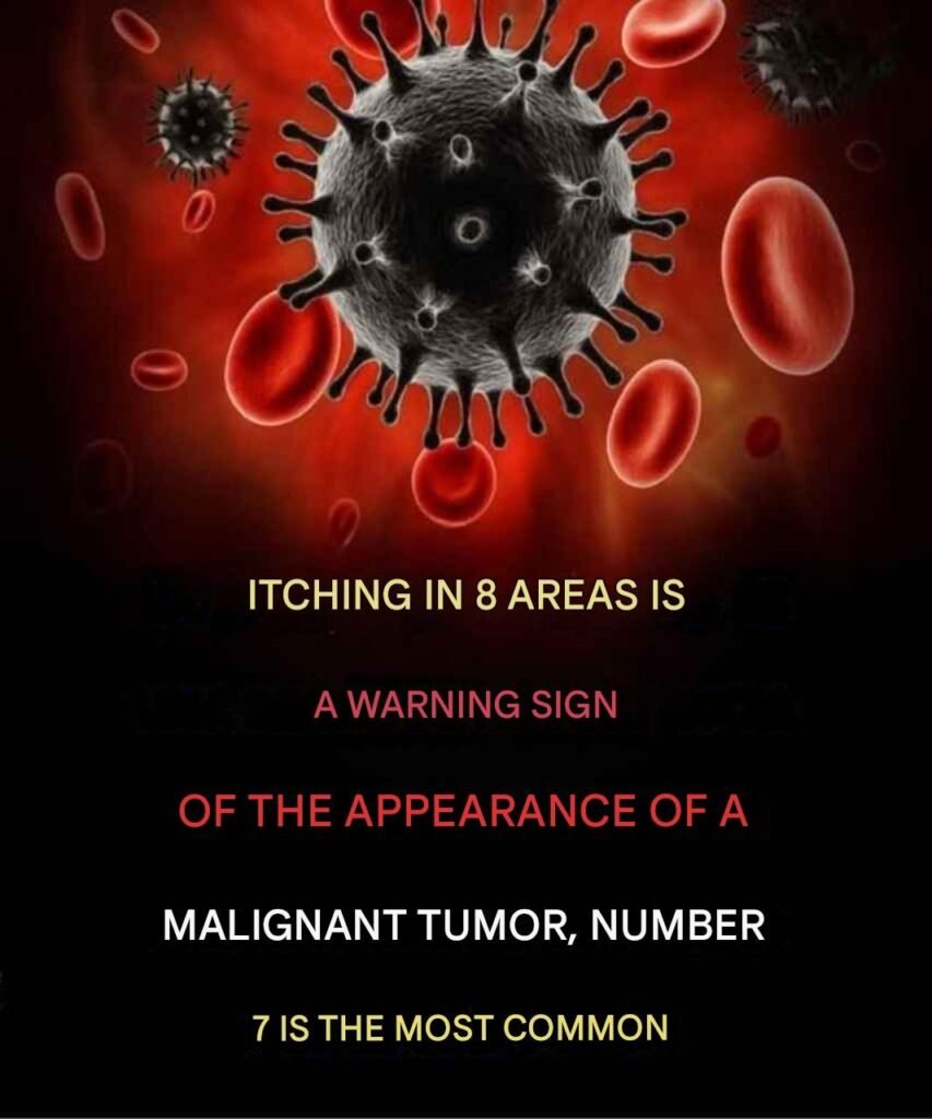 Itching in 8 areas: a warning sign of malignant tumors, number 7 being ...