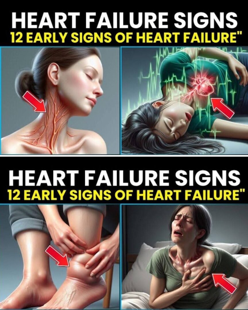Recognizing Early Signs of Heart FailureThe image highlights – Home